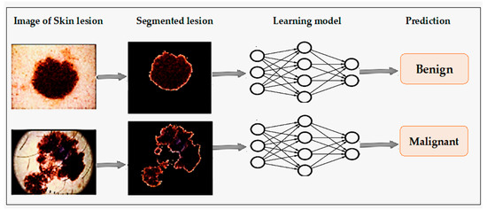 IJERPH | Free Full-Text | Skin Cancer Detection: A Review Using Deep ...