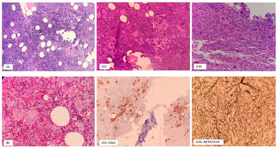 Clinical and Laboratory Features of JAK2 V617F, CALR, and MPL Mutations ...