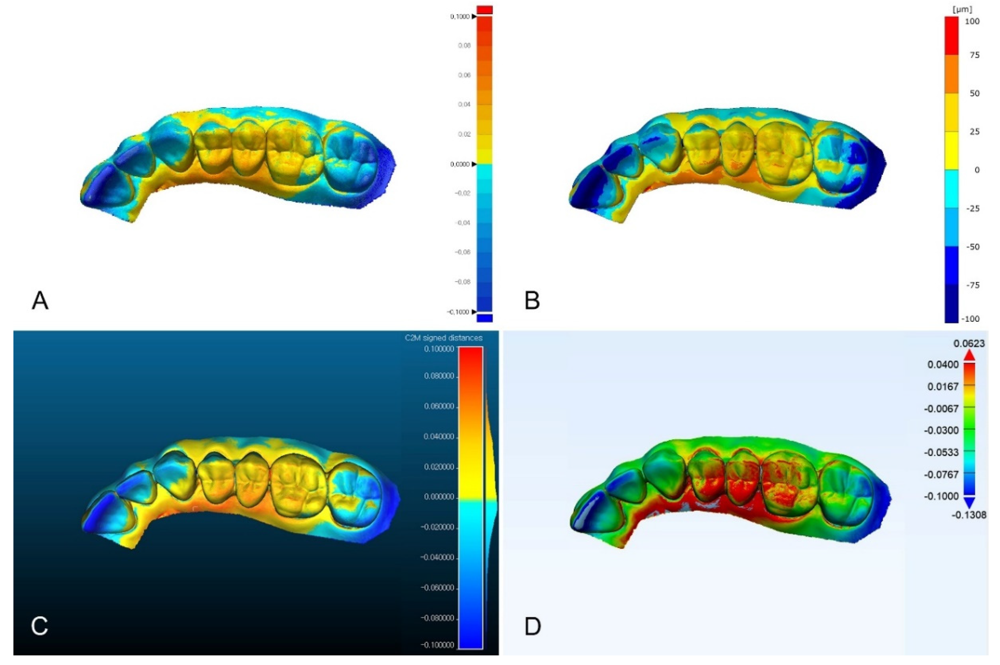 Effect of Different Software Programs on the Accuracy of Dental Scanner ...