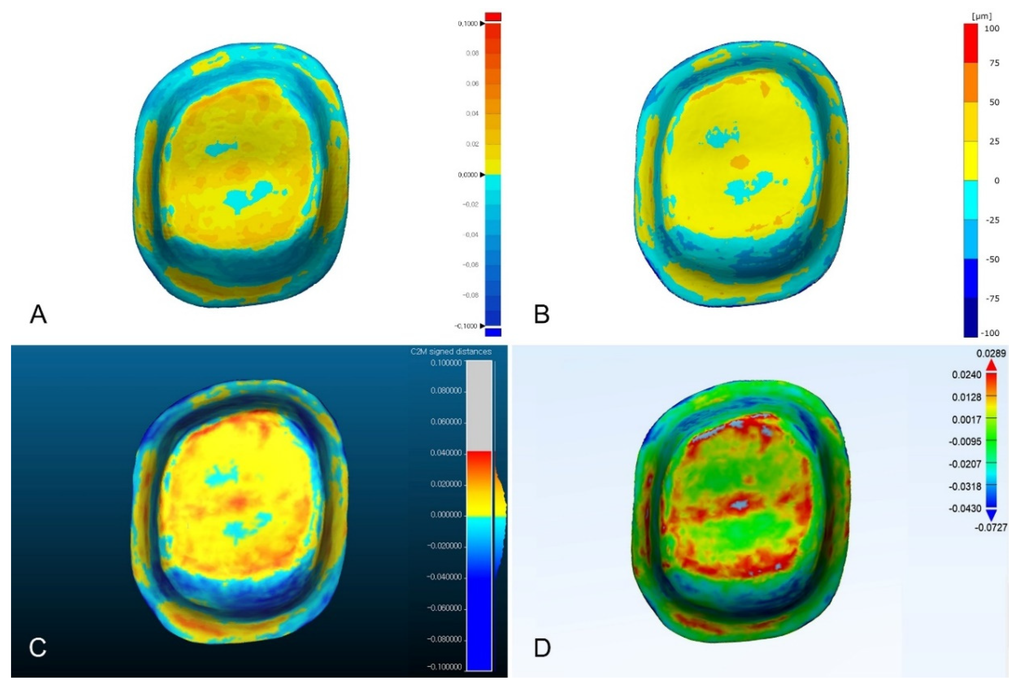 Effect of Different Software Programs on the Accuracy of Dental Scanner ...