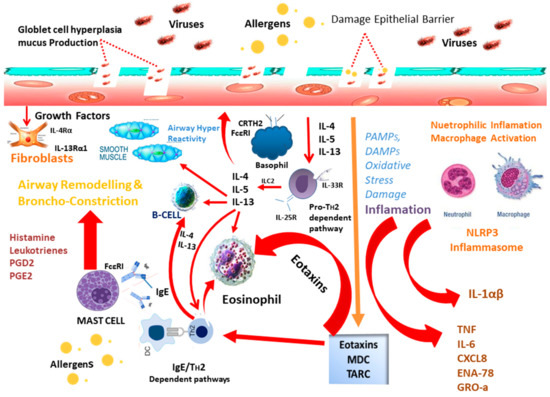 Allergic Diseases: A Comprehensive Review on Risk Factors ...
