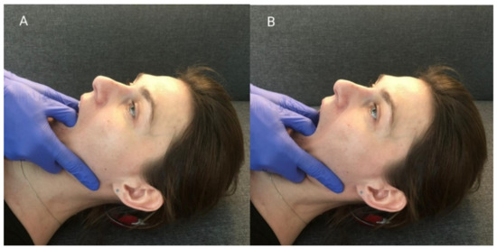 The Application of Manual Techniques in Masticatory Muscles Relaxation ...