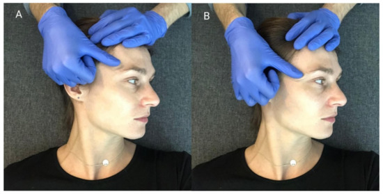 The Application of Manual Techniques in Masticatory Muscles Relaxation ...