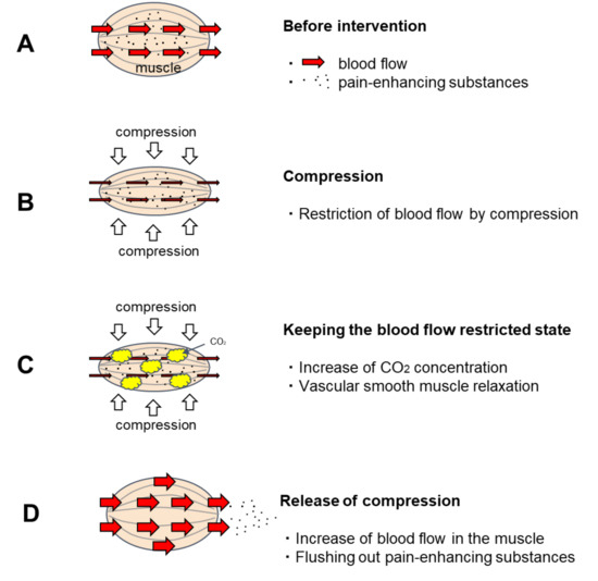 Sustained Compression with a Pneumatic Cuff on Skeletal Muscles ...