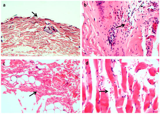 A Clue on the Skin: A Systematic Review on Immunohistochemical Analyses ...