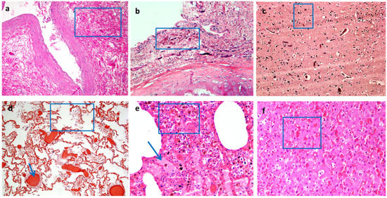 A Clue on the Skin: A Systematic Review on Immunohistochemical Analyses ...