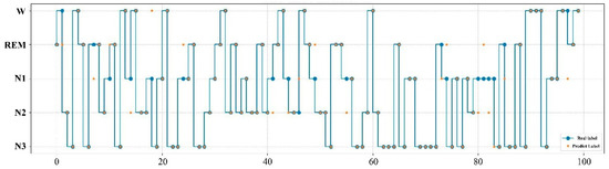 IJERPH | Free Full-Text | Evaluation of a Single-Channel EEG-Based ...