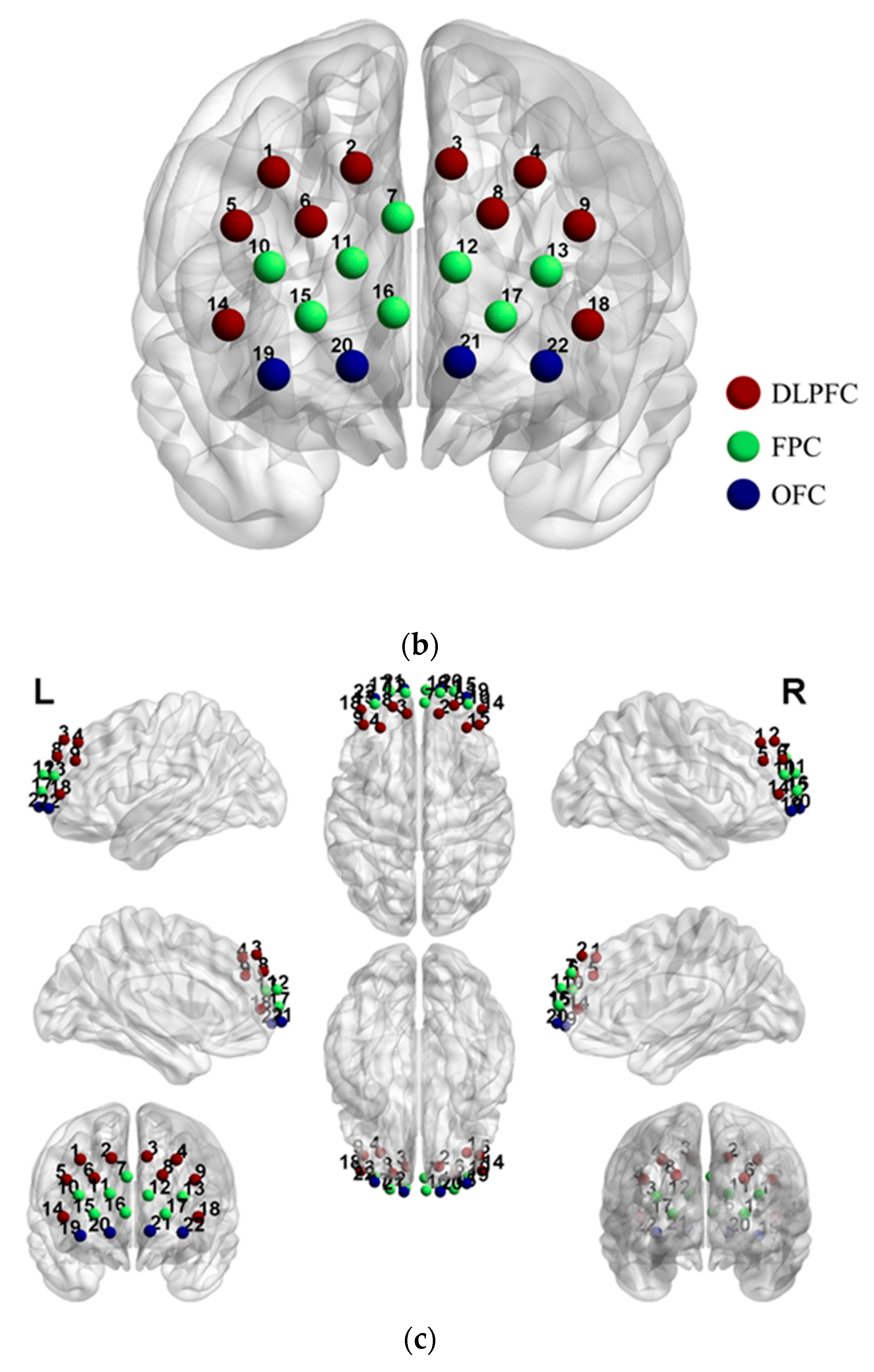 Effect of Shift Work on Cognitive Function in Chinese Coal Mine Workers: A Resting-State fNIRS Study