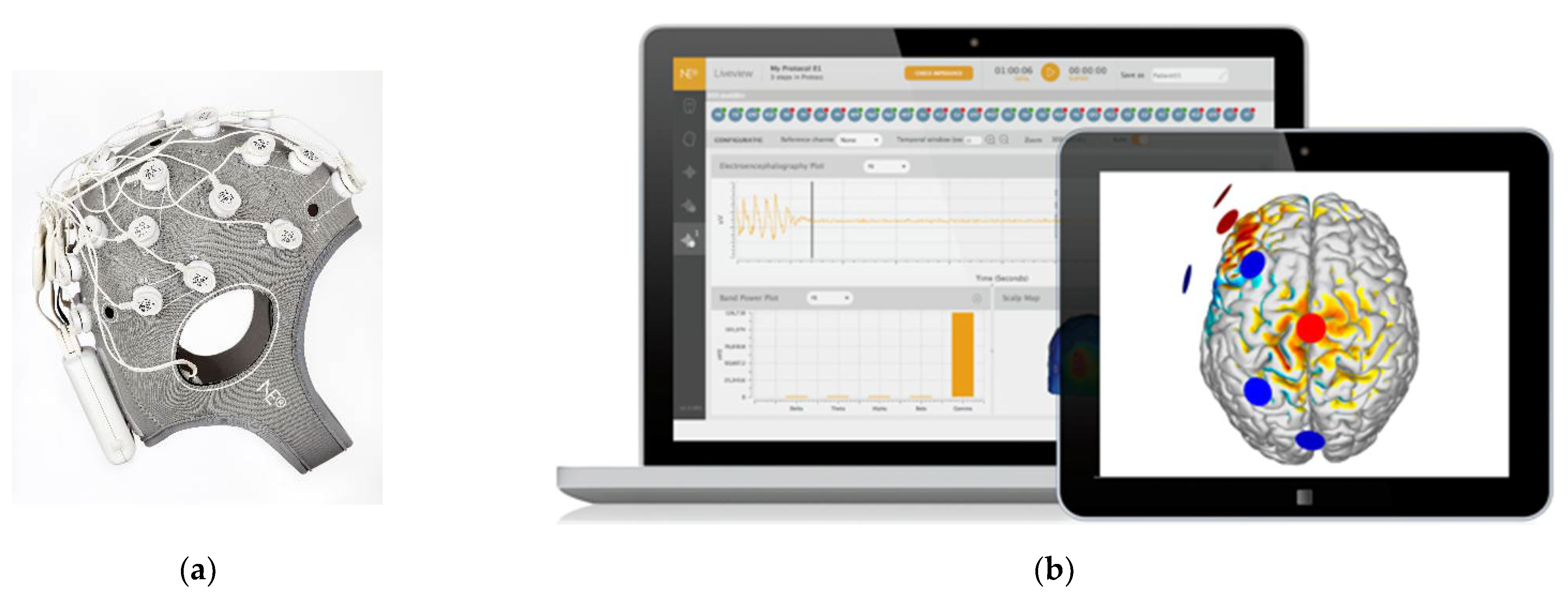BRAINCODE for Cognitive Impairment Diagnosis in Older Adults: Designing ...