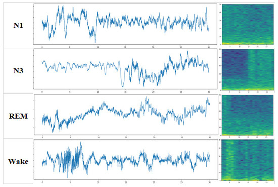 A Deep Learning Method Approach for Sleep Stage Classification with EEG Spectrogram