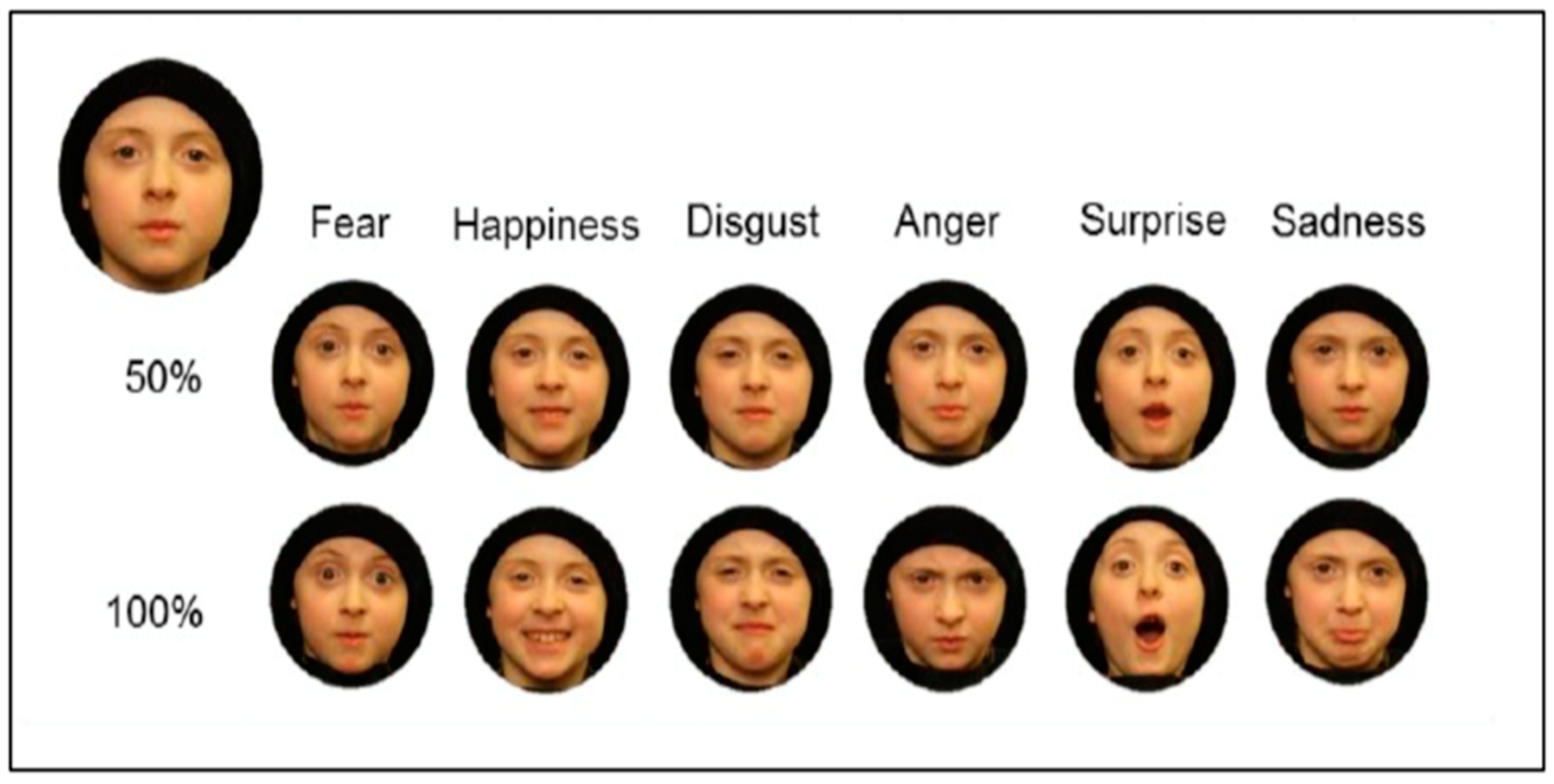Emotion Recognition in Preterm and Full-Term School-Age Children