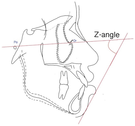 IJERPH | Free Full-Text | Characteristics and Dental Indices of ...