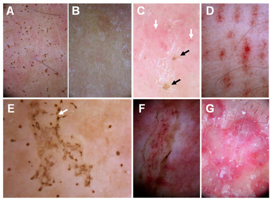 IJERPH | Free Full-Text | Raising Awareness on the Clinical and ...