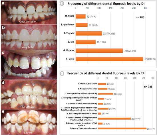 Moderate and Severe Dental Fluorosis in the Rural Population of ...