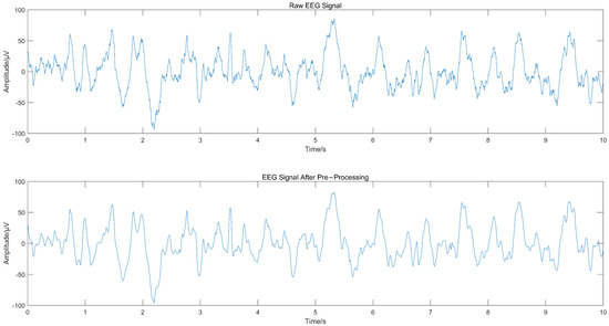 Epilepsy Seizures Prediction Based on Nonlinear Features of EEG Signal ...
