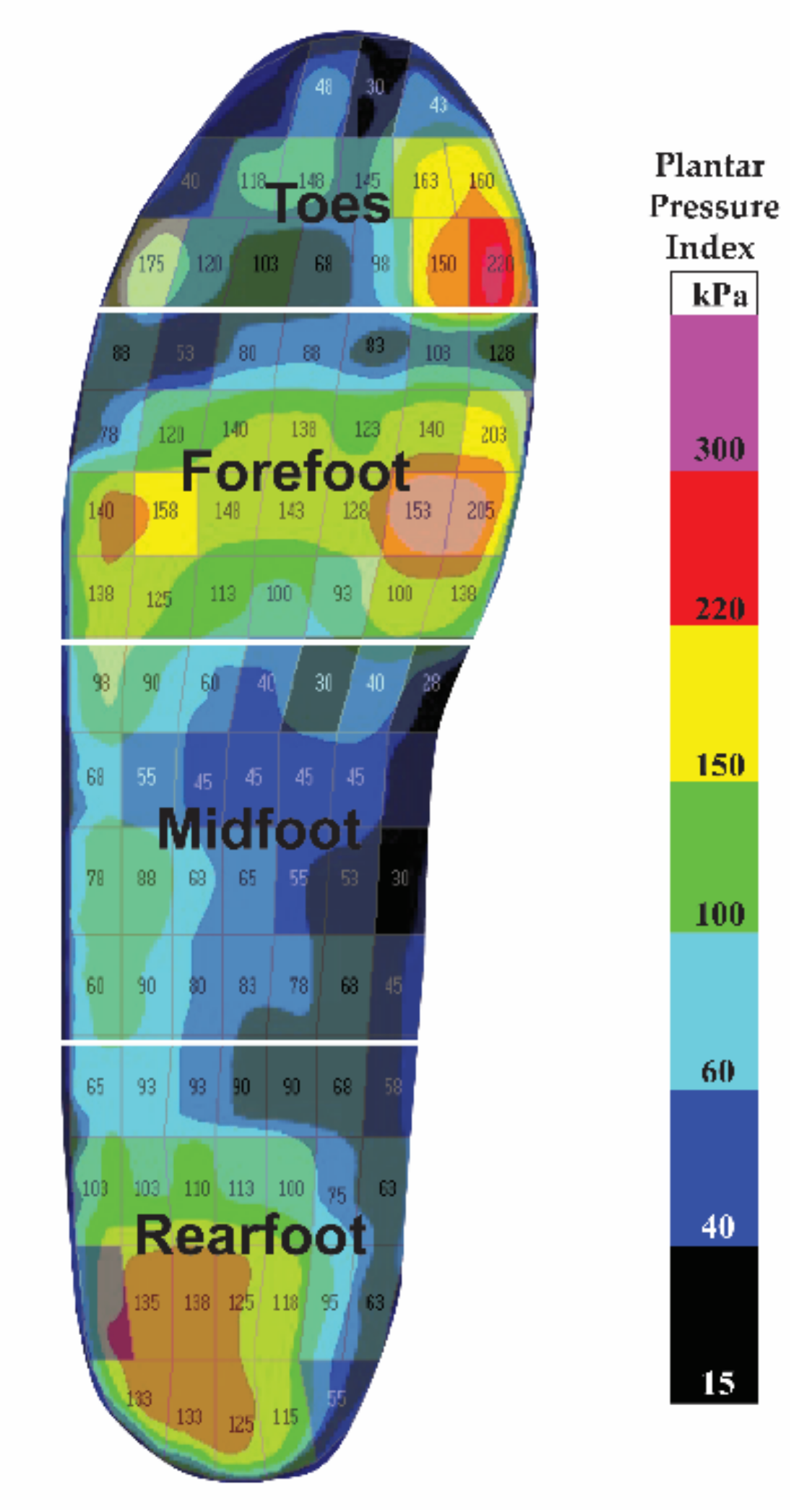 Influence of Contoured Insoles with Different Materials on Kinematics ...