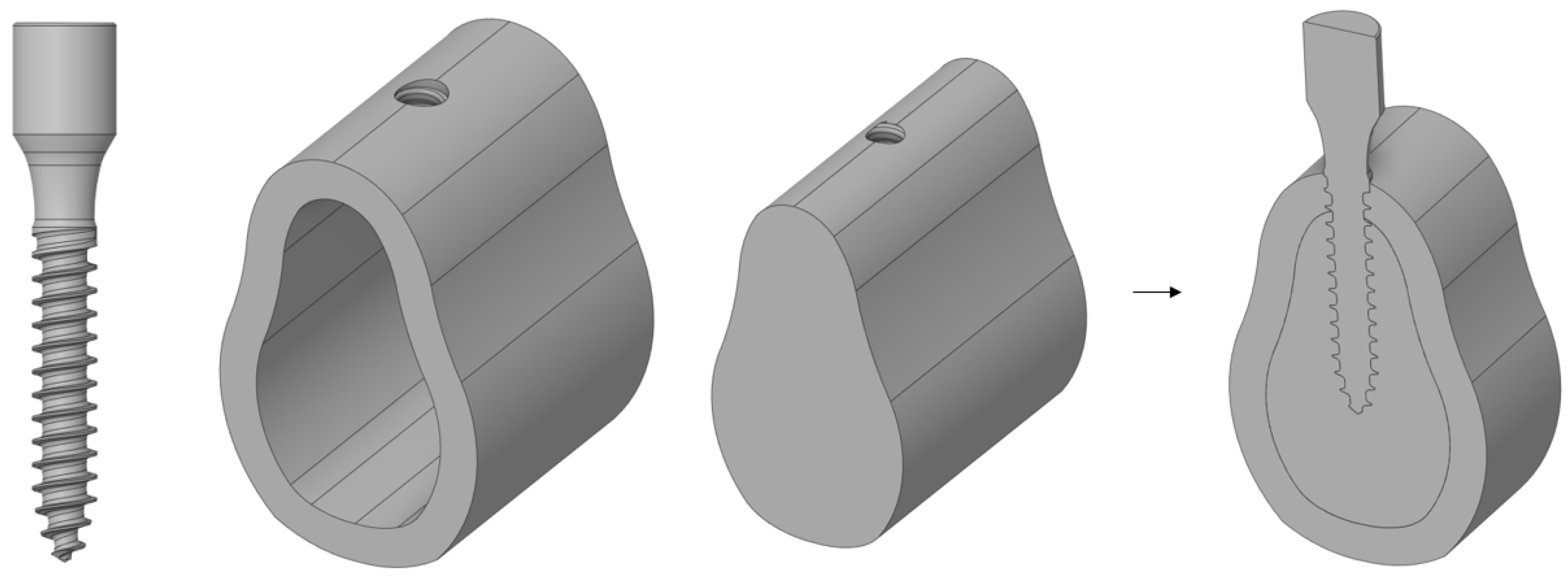 Stress Distribution Analysis of Threaded Implants for Digital Dentistry