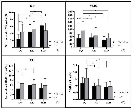 Quadriceps Electromyographic Activity in Closed and Open Kinetic-Chain ...