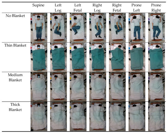 Depth-Camera-Based Under-Blanket Sleep Posture Classification Using Anatomical Landmark-Guided ...