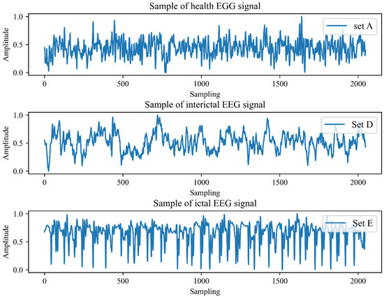 A Novel Epilepsy Detection Method Based on Feature Extraction by Deep Autoencoder on EEG Signal
