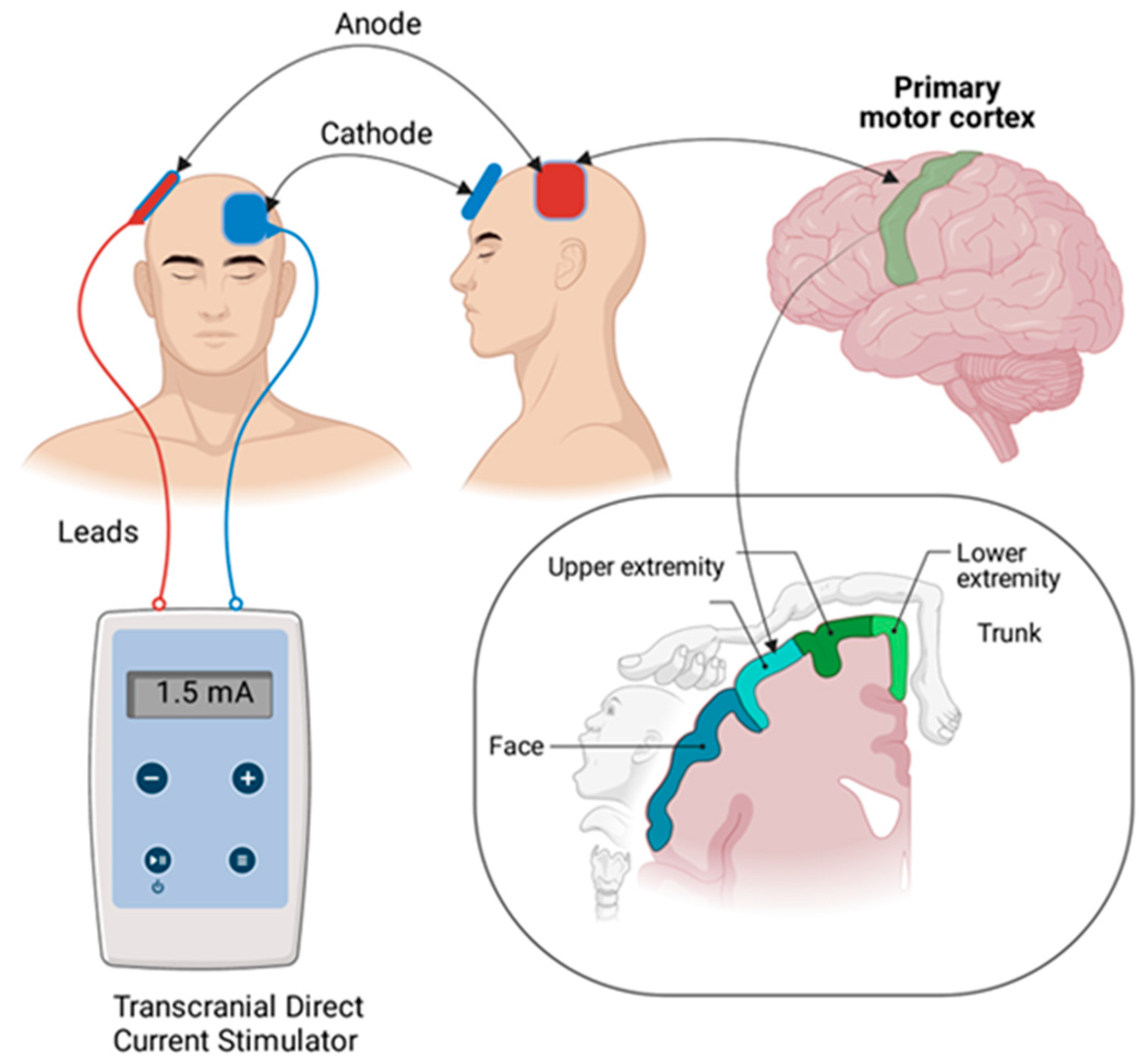Transcranial Direct Current Stimulation Electrode Placement Transcranial Direct Current Stimulation Electrode Placement