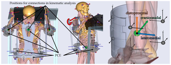 Model-Based Biomechanical Exoskeleton Concept Optimization for a ...
