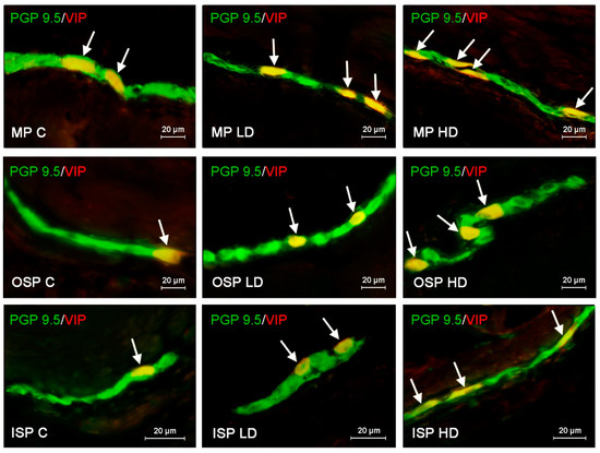 IJERPH | Free Full-Text | Changes in the Enteric Neurons Containing ...