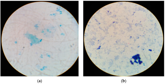 Performance of Bleach Method Sputum Smear Microscopy for the Diagnosis ...