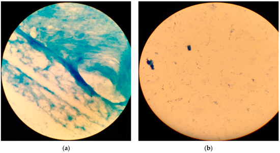 Performance of Bleach Method Sputum Smear Microscopy for the Diagnosis ...