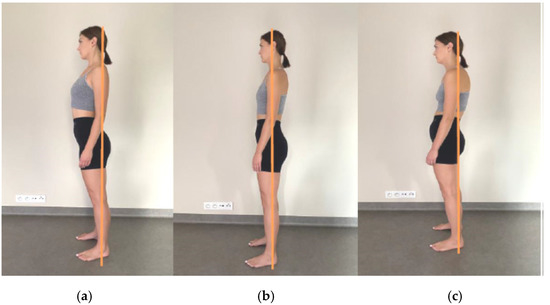 IJERPH | Free Full-Text | Posture Correction Therapy and Pelvic Floor ...