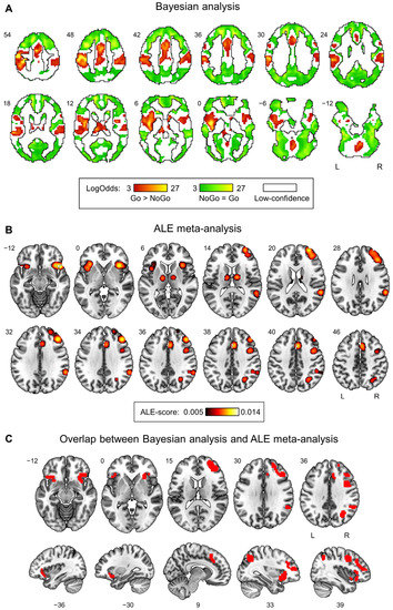 Impaired Non-Selective Response Inhibition in Obsessive-Compulsive Disorder