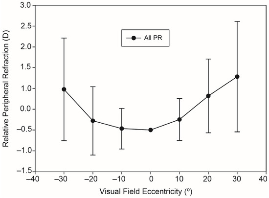 Peripheral Refraction of Two Myopia Control Contact Lens Models in a ...