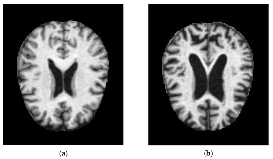 Identification of Alzheimer’s Disease by Imaging: A Comprehensive Review