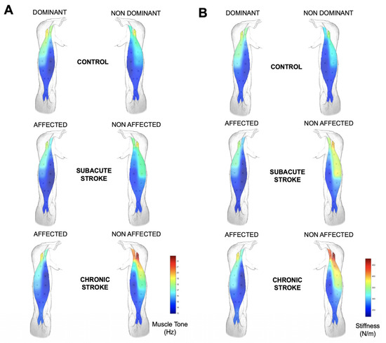 Characterization of the Structural and Mechanical Changes of the Biceps ...