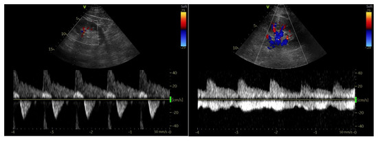 The Incremental Role of Multiorgan Point-of-Care Ultrasounds in the ...