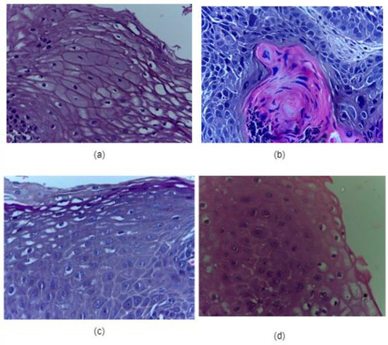 Automatic Detection of Oral Squamous Cell Carcinoma from ...
