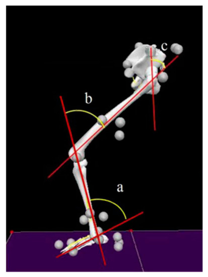 Effects of Bilateral Extracephalic Transcranial Direct Current ...