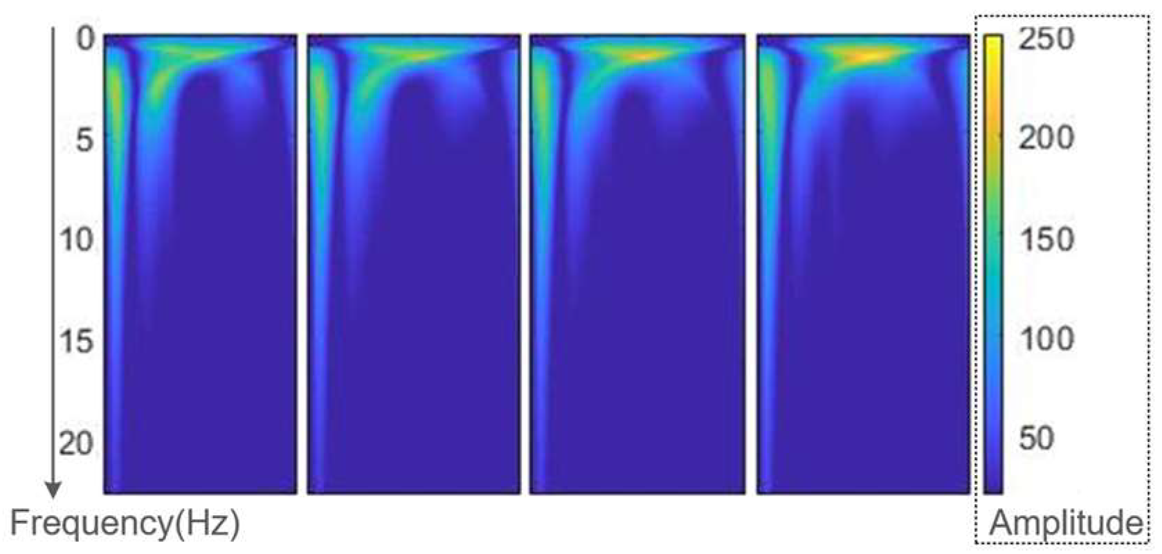 Pulse Wave Analysis Method of Cardiovascular Parameters Extraction for ...