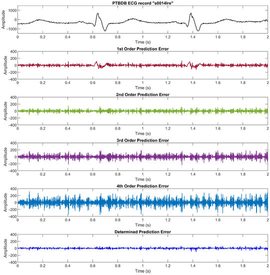 Signal Acquisition-Independent Lossless Electrocardiogram Compression Using Adaptive Linear ...