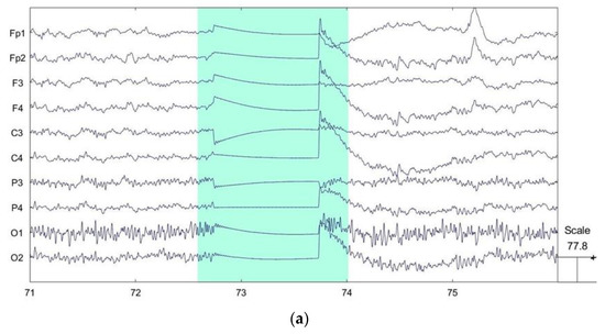Multi-Level Attention Recognition of EEG Based on Feature Selection