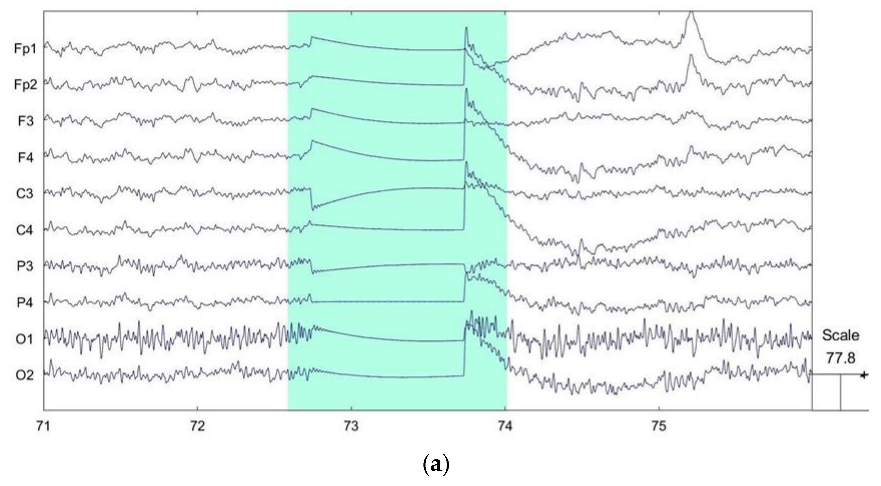 Multi-Level Attention Recognition of EEG Based on Feature Selection