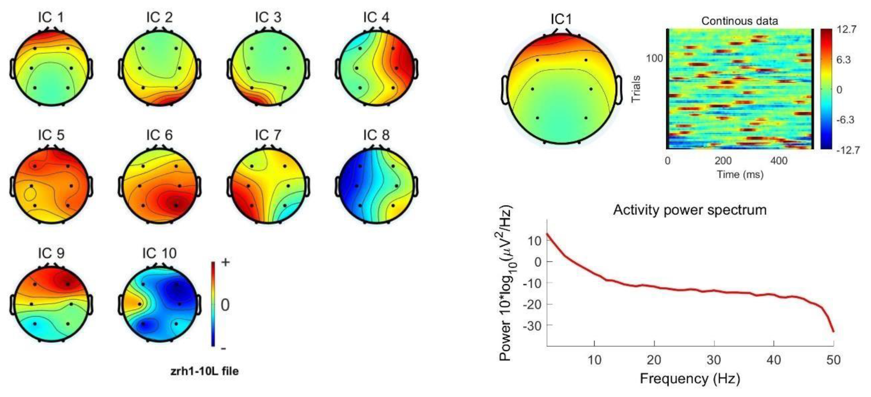 Multi-Level Attention Recognition of EEG Based on Feature Selection
