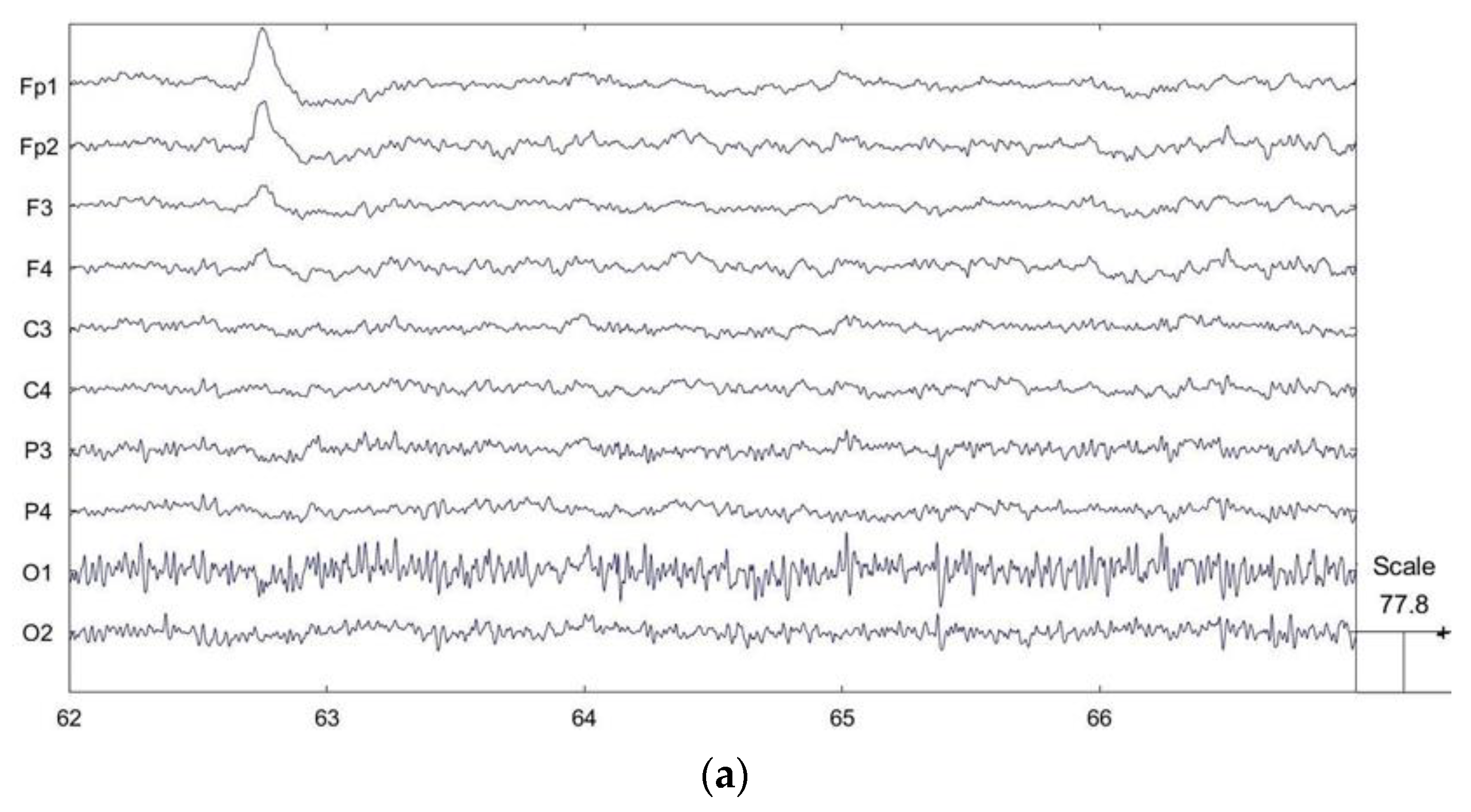 Multi-Level Attention Recognition of EEG Based on Feature Selection