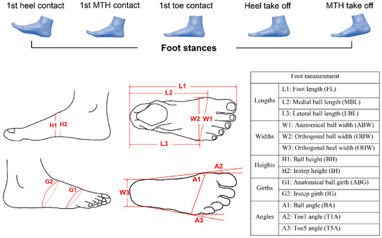 Analysis of Diabetic Foot Deformation and Plantar Pressure Distribution ...