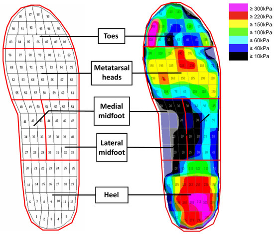 IJERPH | Free Full-Text | Analysis of Diabetic Foot Deformation and ...