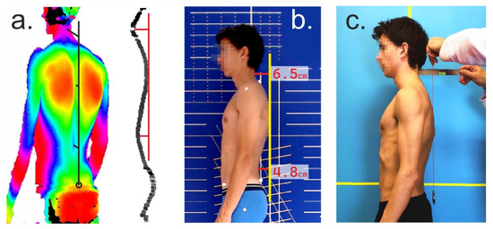 Reference Values for Sagittal Clinical Posture Assessment in People ...