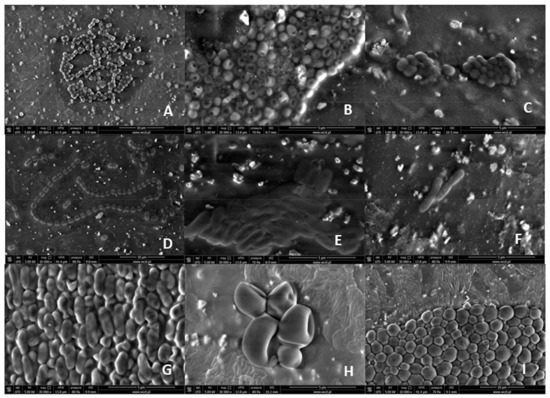 Scanning Electron Microscope Examination as an Alternative to Classical ...