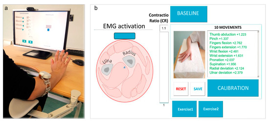 Clinical Features to Predict the Use of a sEMG Wearable Device (REMO ...