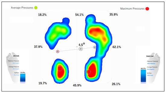 Characteristics of Pressure on the Apophysis in the Course of ...