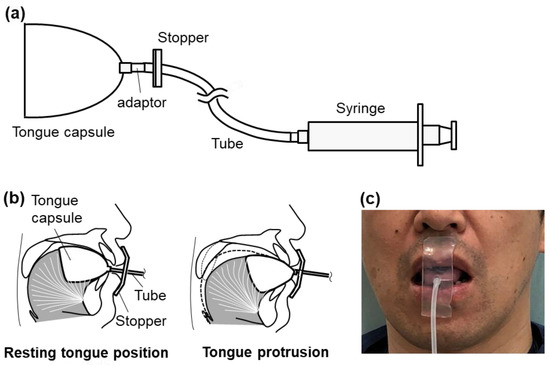 Control of Tongue Position in Patients with Obstructive Sleep Apnea ...
